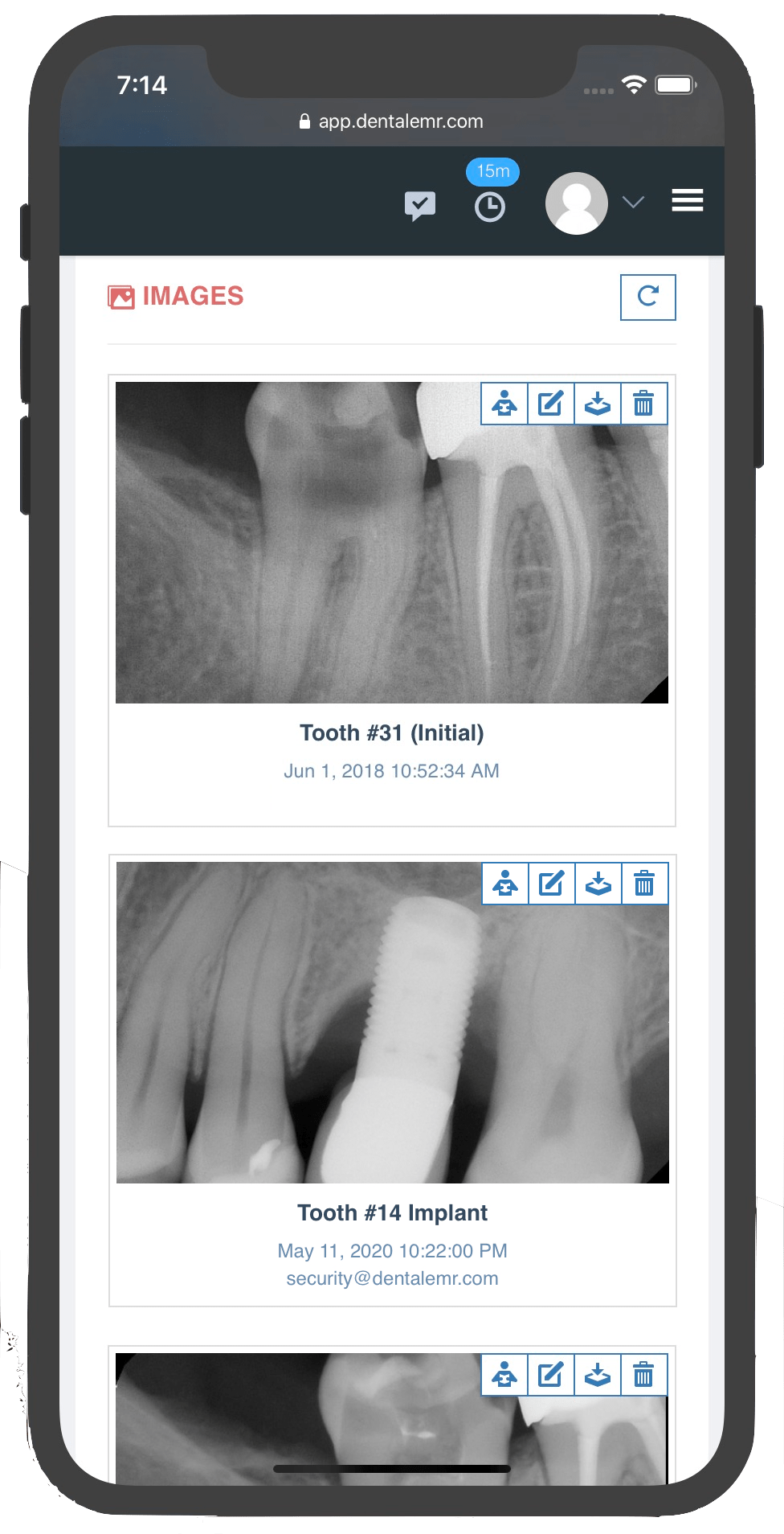 Dental EMR - The ONLY Web-based Endodontic Practice Management Software